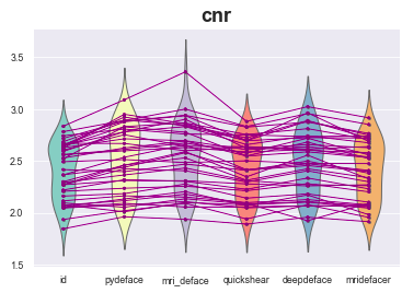 Defacing – Centre IRM – INT