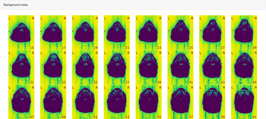 Visual inspection and Quality checks – Centre IRM – INT