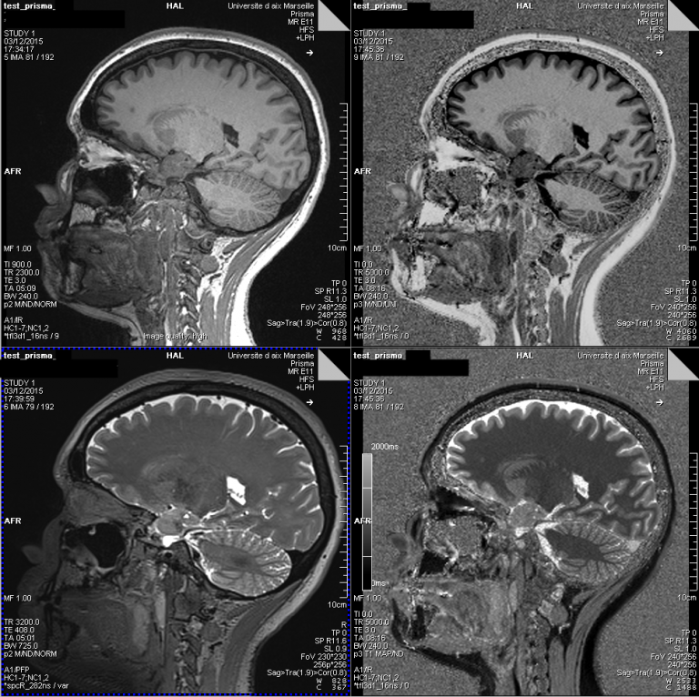 Séquences IRM disponibles – Centre IRM – INT