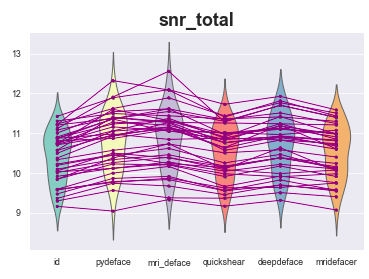 Defacing – Centre IRM – INT