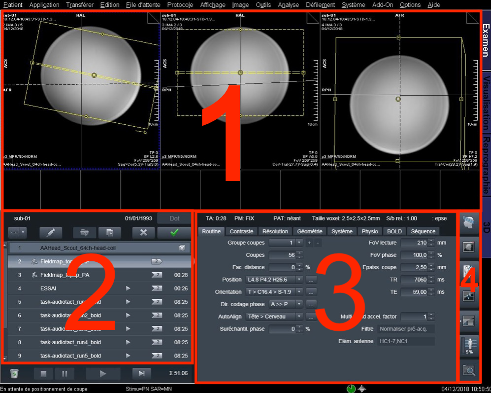 Launching the MRI acquistion – Centre IRM – INT