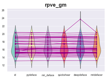 Defacing – Centre IRM – INT