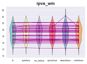 Defacing – Centre IRM – INT